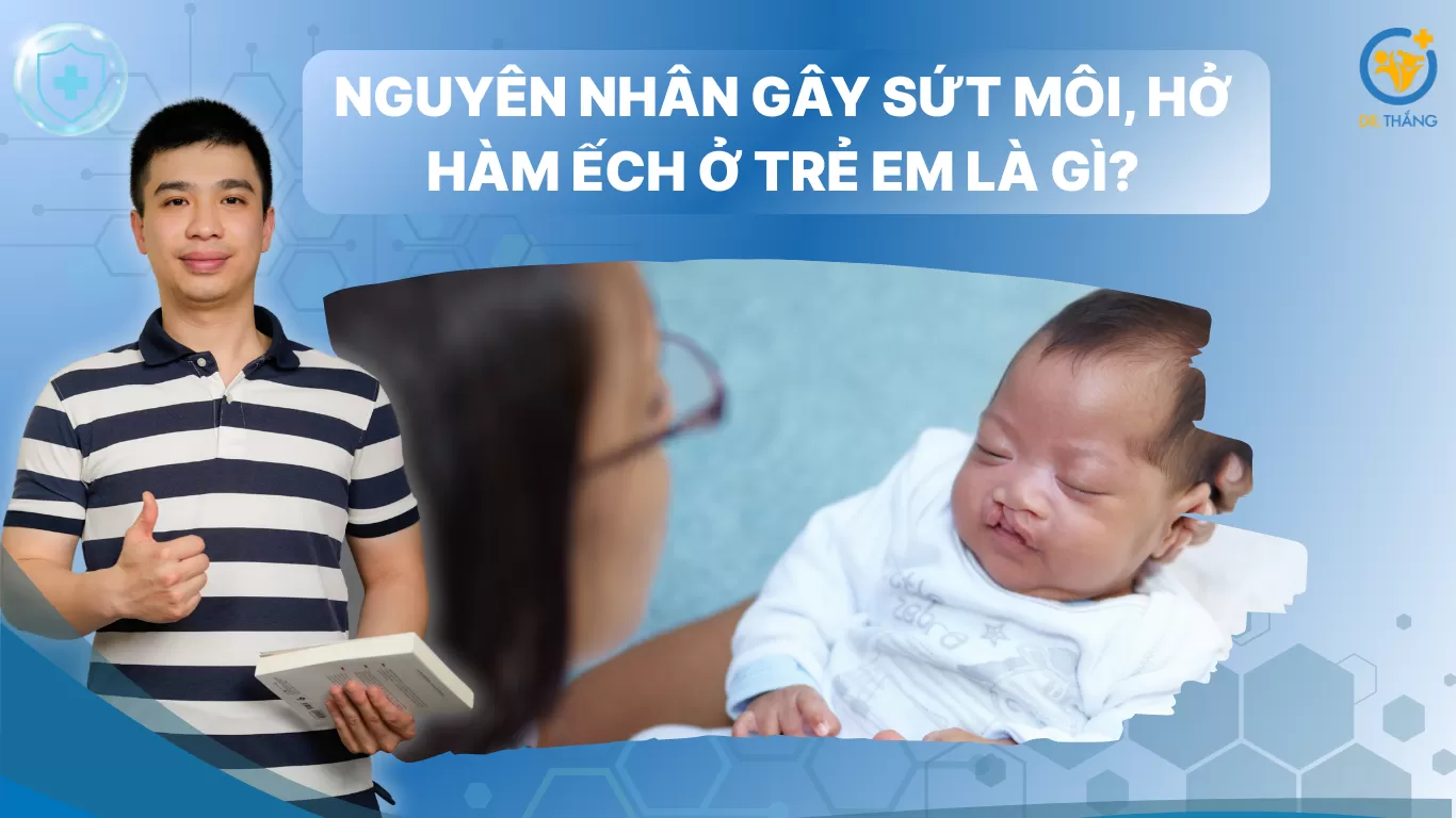 Nguyên nhân gây sứt môi, hở hàm ếch ở trẻ em là gì?